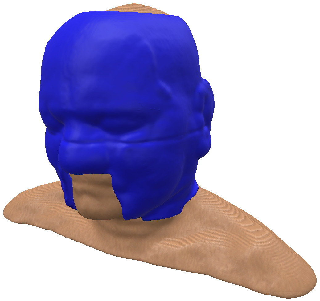 Custom Silicone Bolus